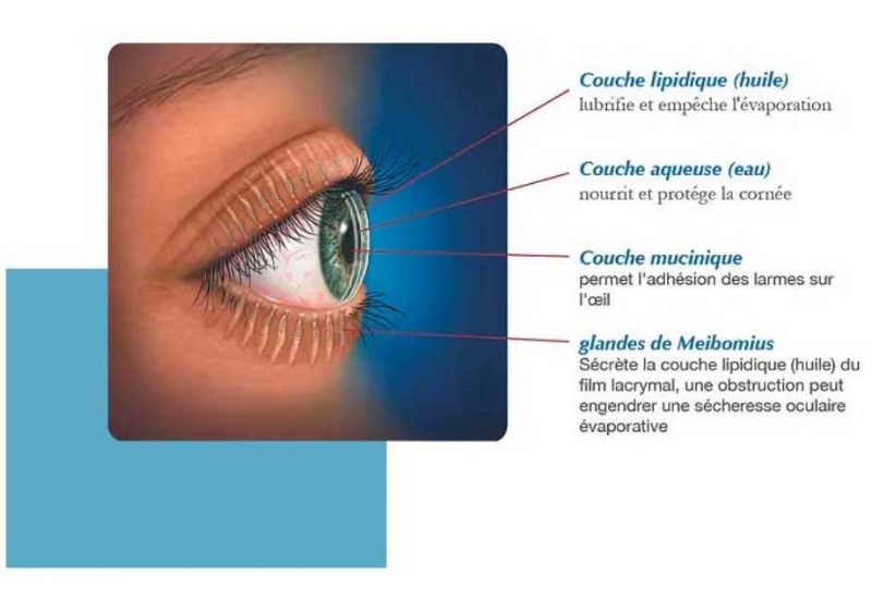 Comprendre - ACOS France